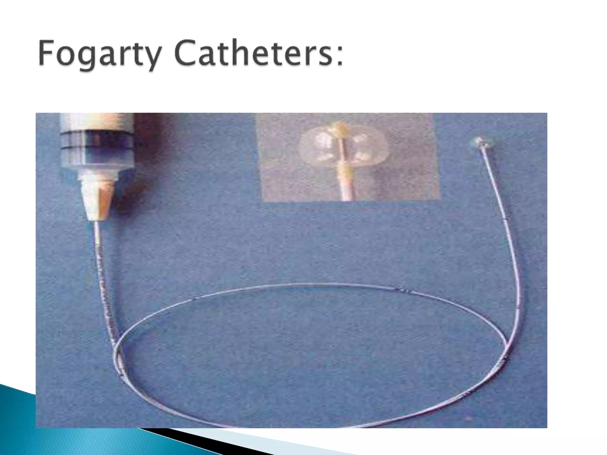 Arterial and venous embolectomy | PPTX
