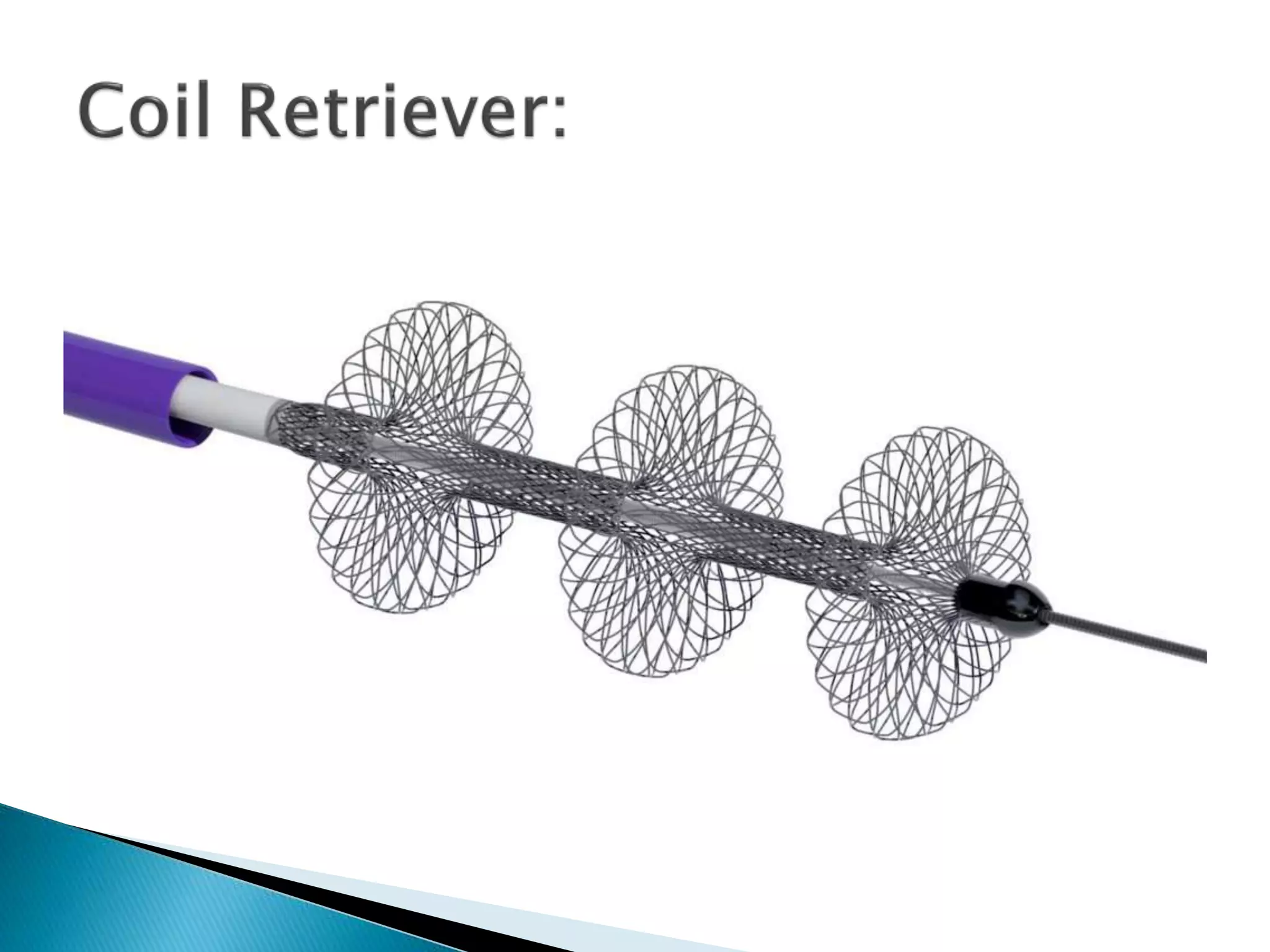 Arterial and venous embolectomy | PPTX