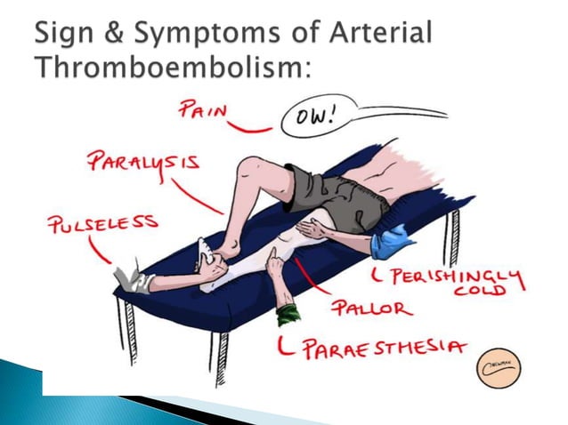 Arterial and venous embolectomy | PPTX | Blood Disorders | Diseases and ...