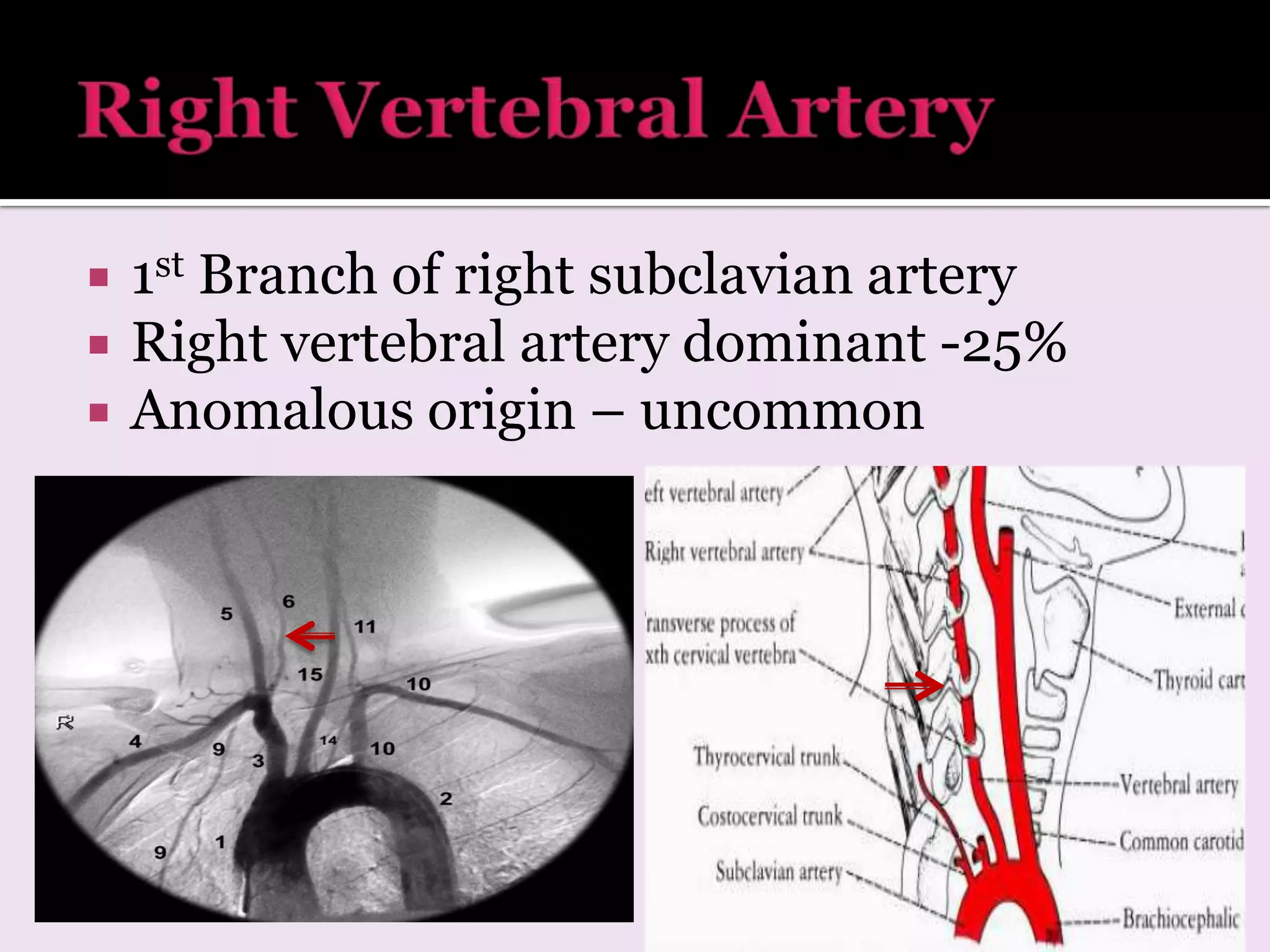 radiology Arterial and venous supply of brain neuroimaging part 1 | PPTX