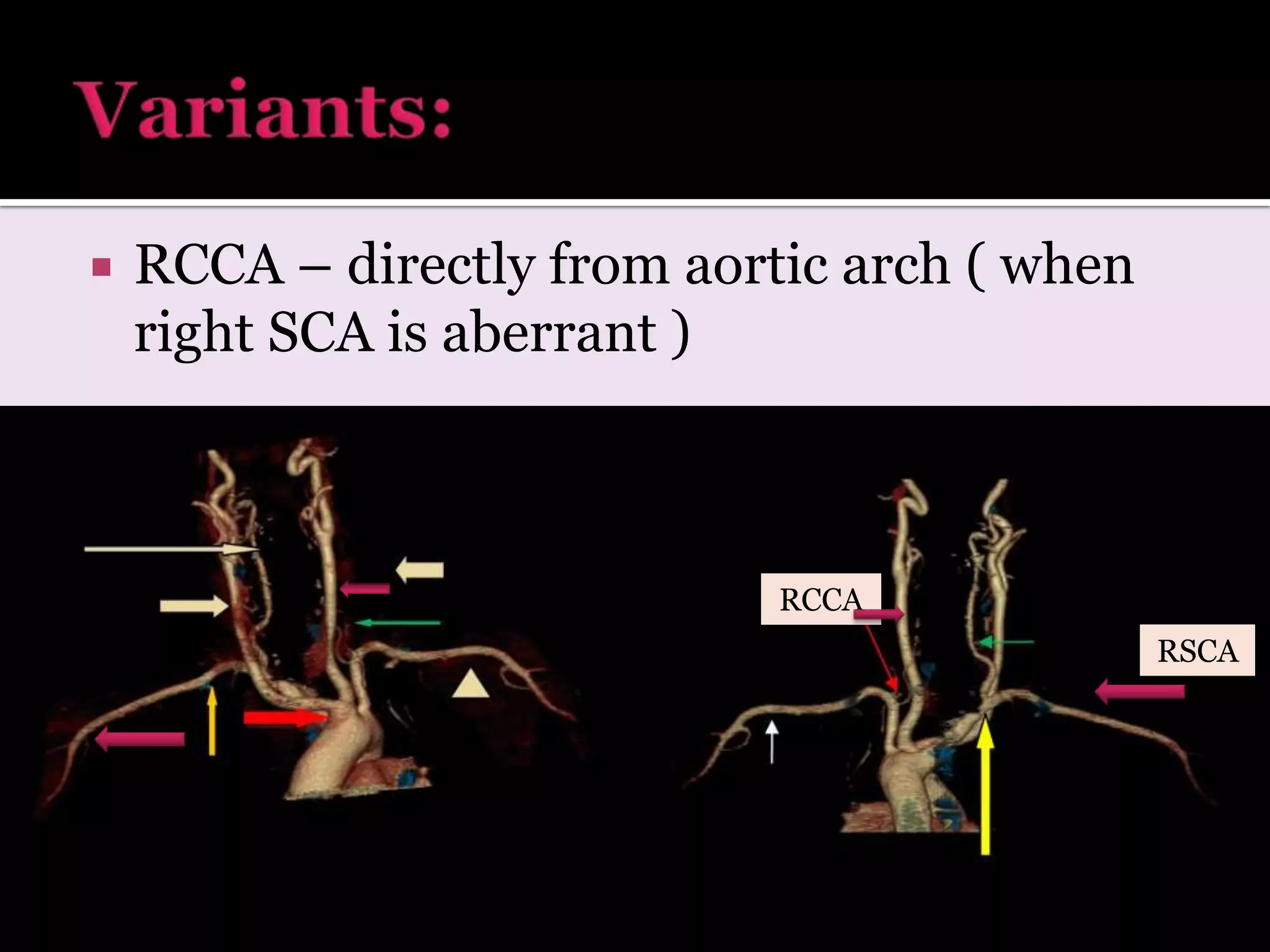 radiology Arterial and venous supply of brain neuroimaging part 1 | PPTX