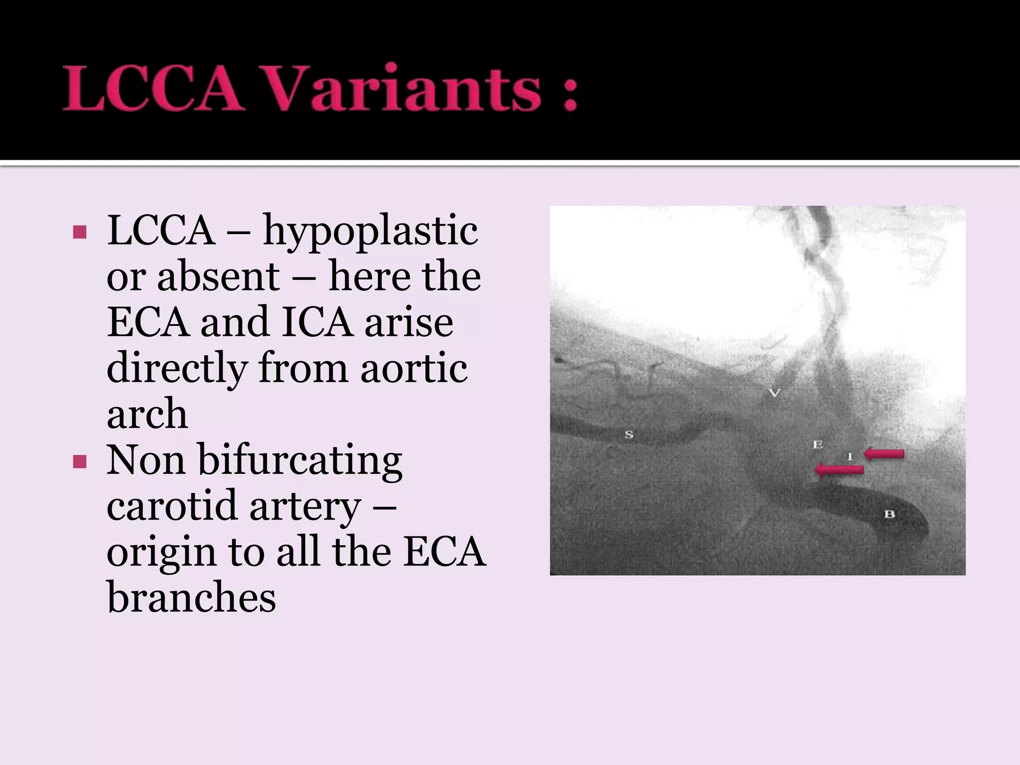 radiology Arterial and venous supply of brain neuroimaging part 1 | PPTX