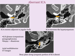 radiology Arterial and venous supply of brain neuroimaging part 1 | PPTX