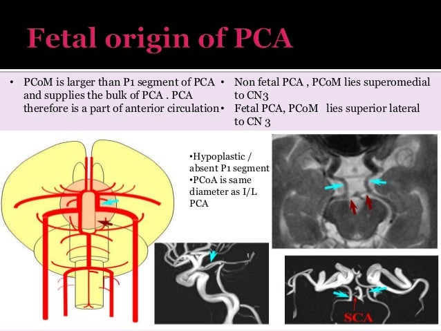 radiology Arterial and venous supply of brain neuroimaging part 1