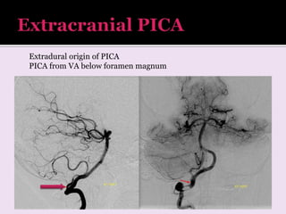 Arterial and venous supply of brain part2 | PPTX