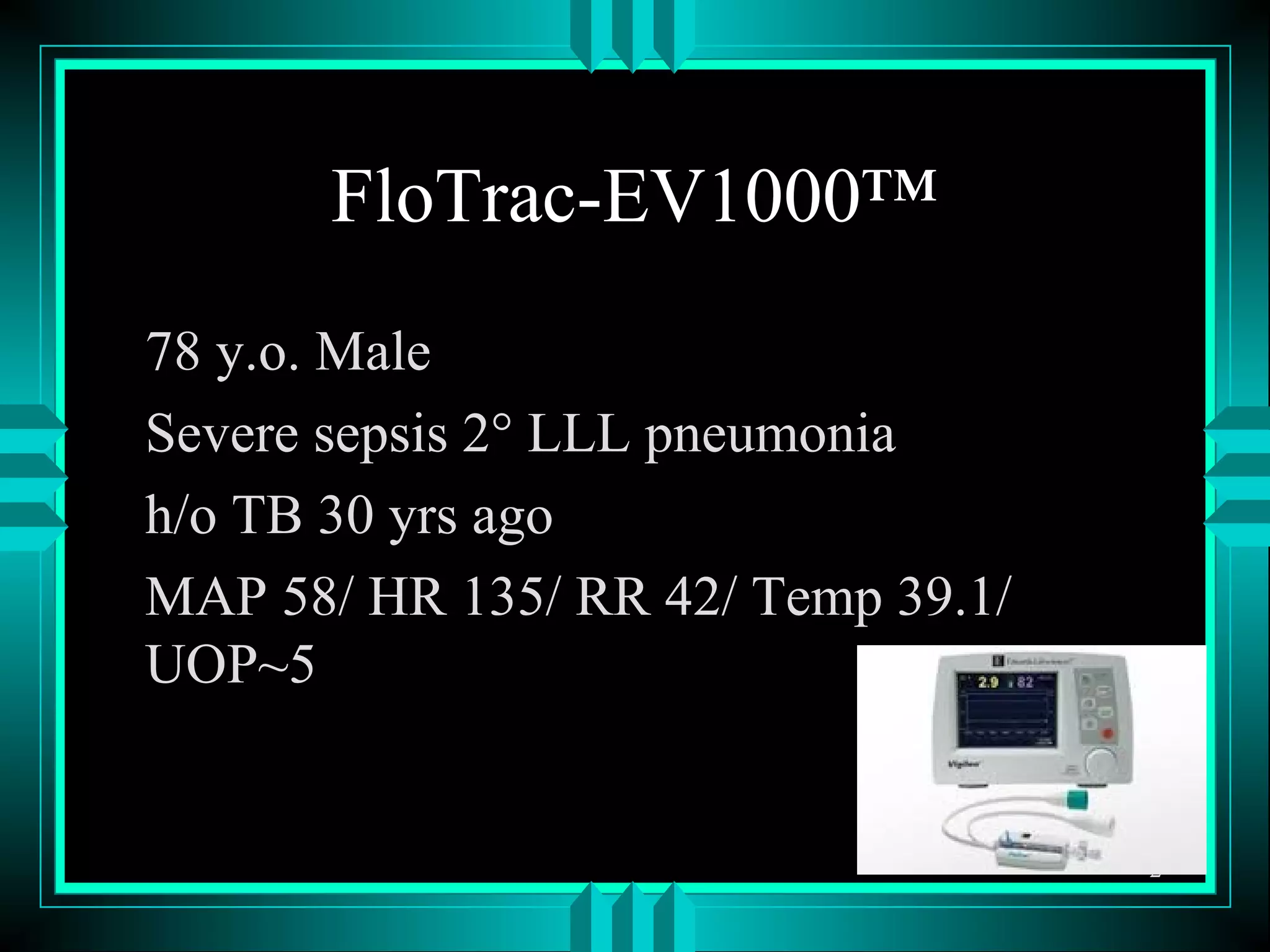 Using Arterial Pressure Based Cardiac Output to Guide Therapy - Chris Saraceno | PPT