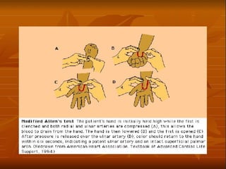 Arterial Blood Bas (ABG) Procedure and Interpretation | PPT