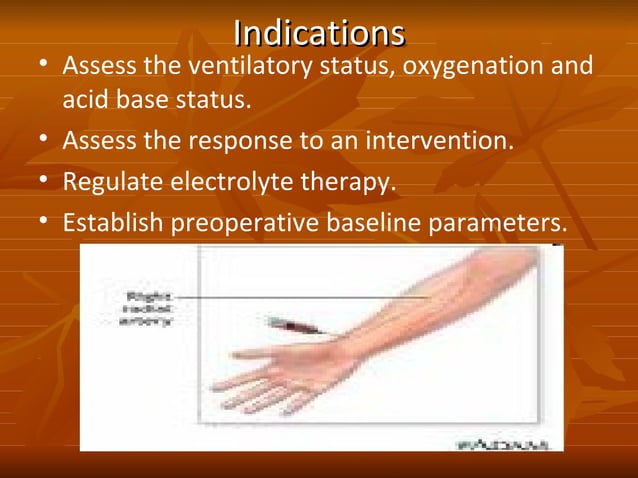 Arterial Blood Bas (ABG) Procedure and Interpretation | PPT | First Aid ...