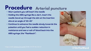 Arterial Blood Gas Sampling PowerPoint (OnTheWard.com) | PDF