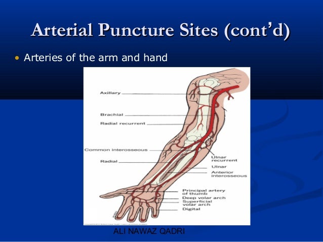 Arterial Blood Gassess