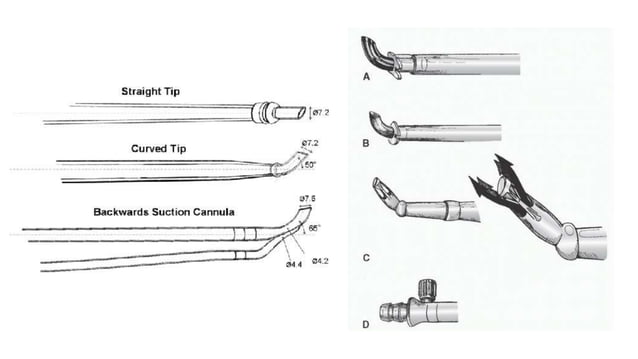 Arterial Cannulation in cardio thoracic surgery | PPTX