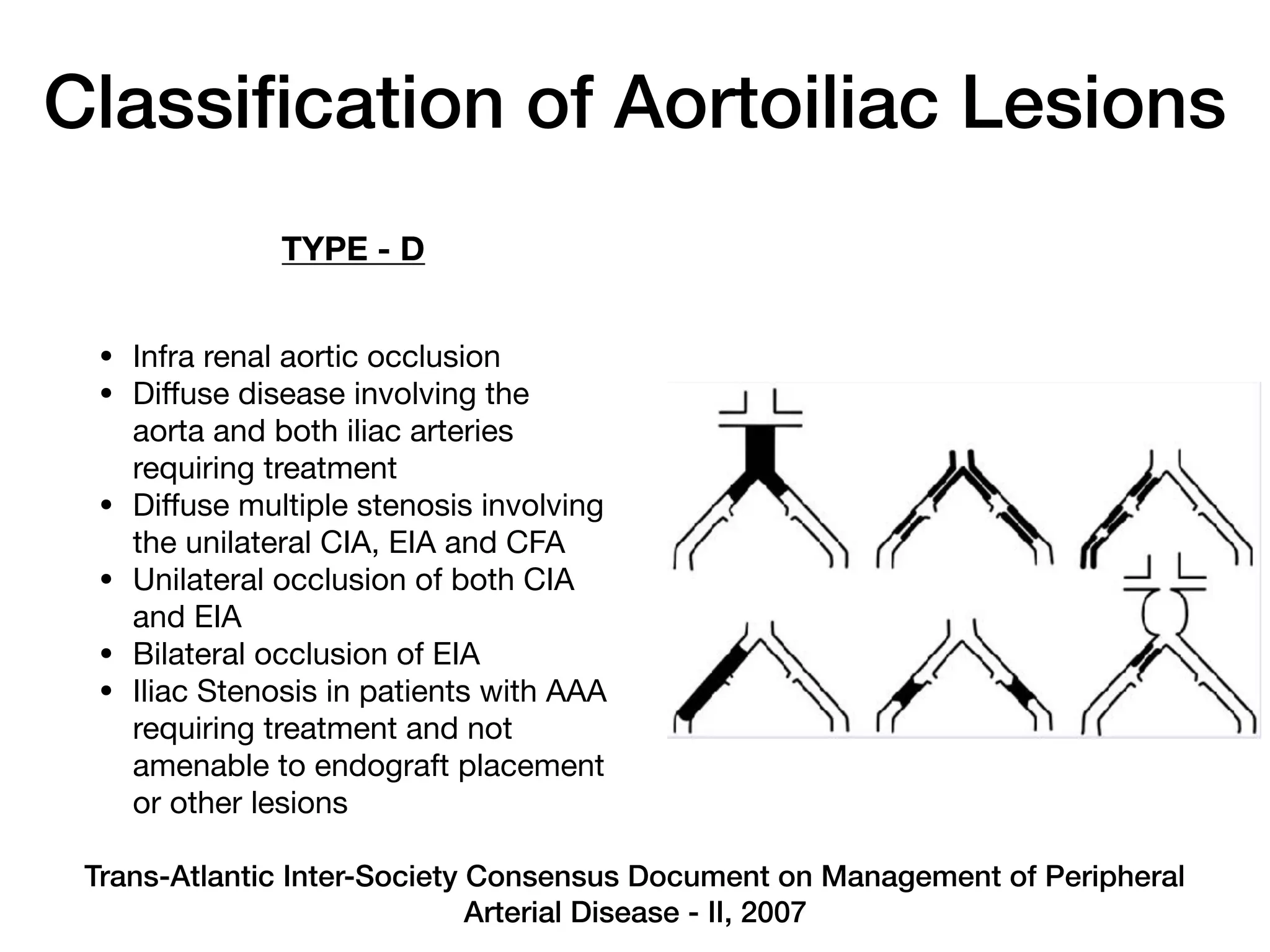 Arterial disease | PDF