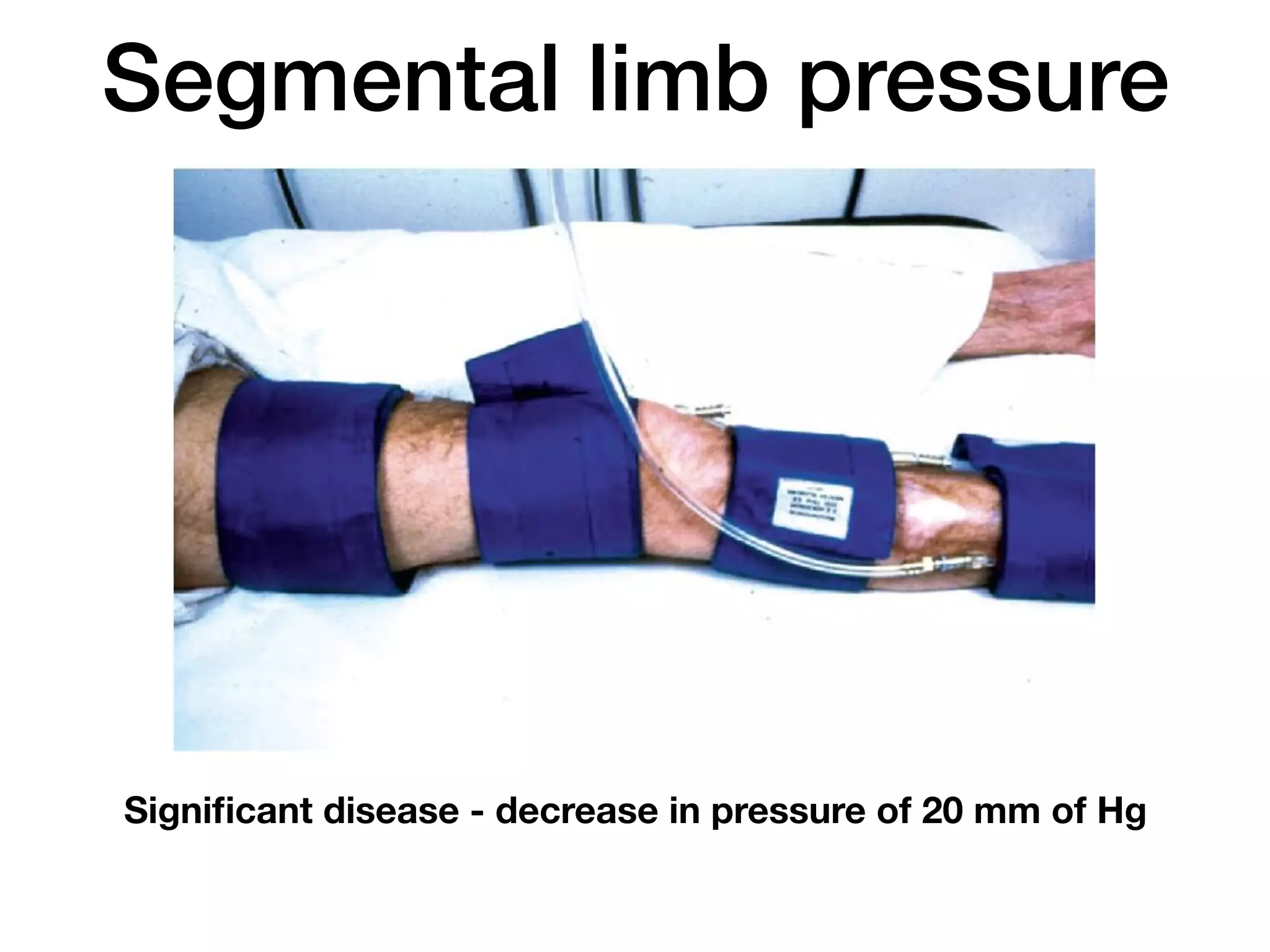 Arterial disease | PDF