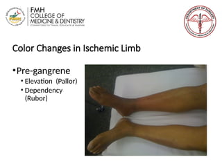 Arterial Disorders Including Acute and Chronic Limb Ischemia | PPTX