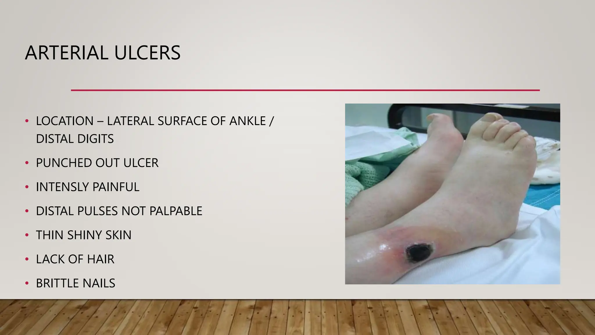 Arterial disorders PPT.pptx............. | PPTX