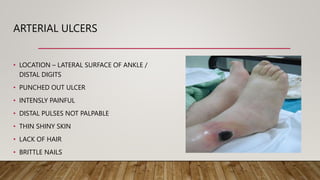 Arterial disorders PPT.pptx............. | PPTX