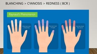 Arterial disorders PPT.pptx............. | PPTX