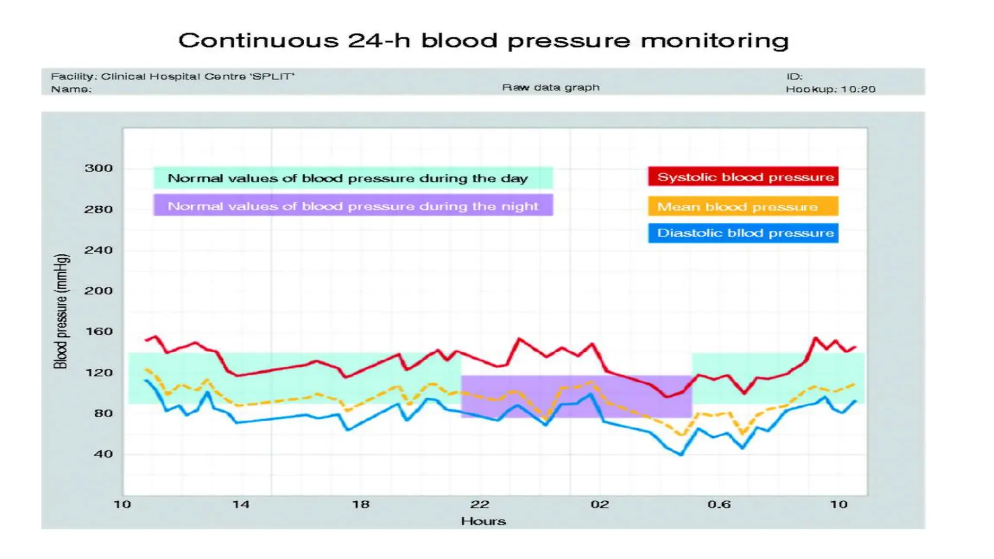 Arterial hypertension, blood pressure ppt | PPT