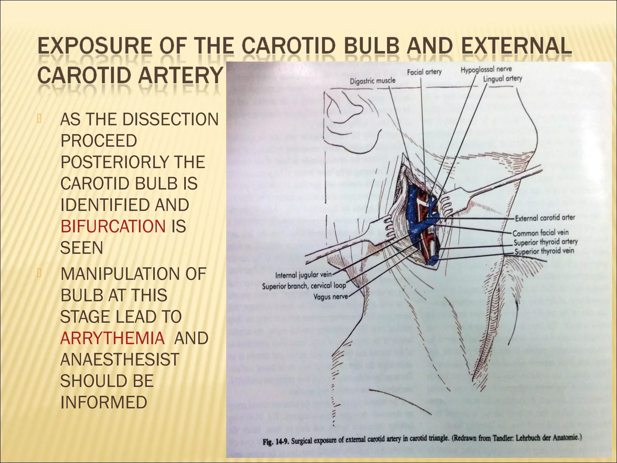 VESSEL ligation | PPT