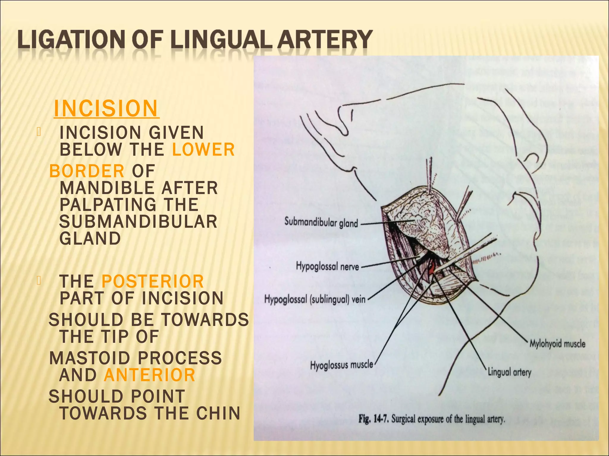 VESSEL ligation | PPT