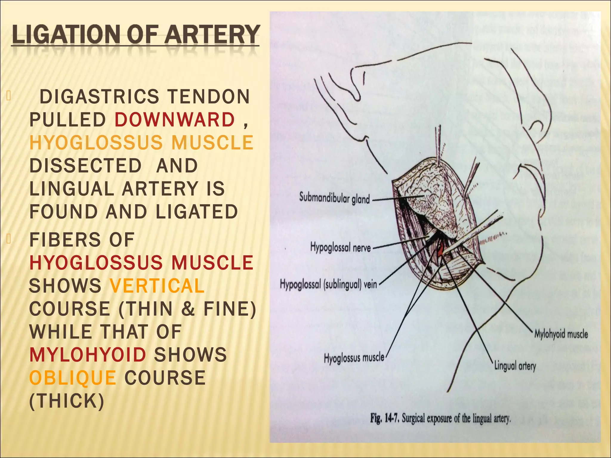 VESSEL ligation | PPT