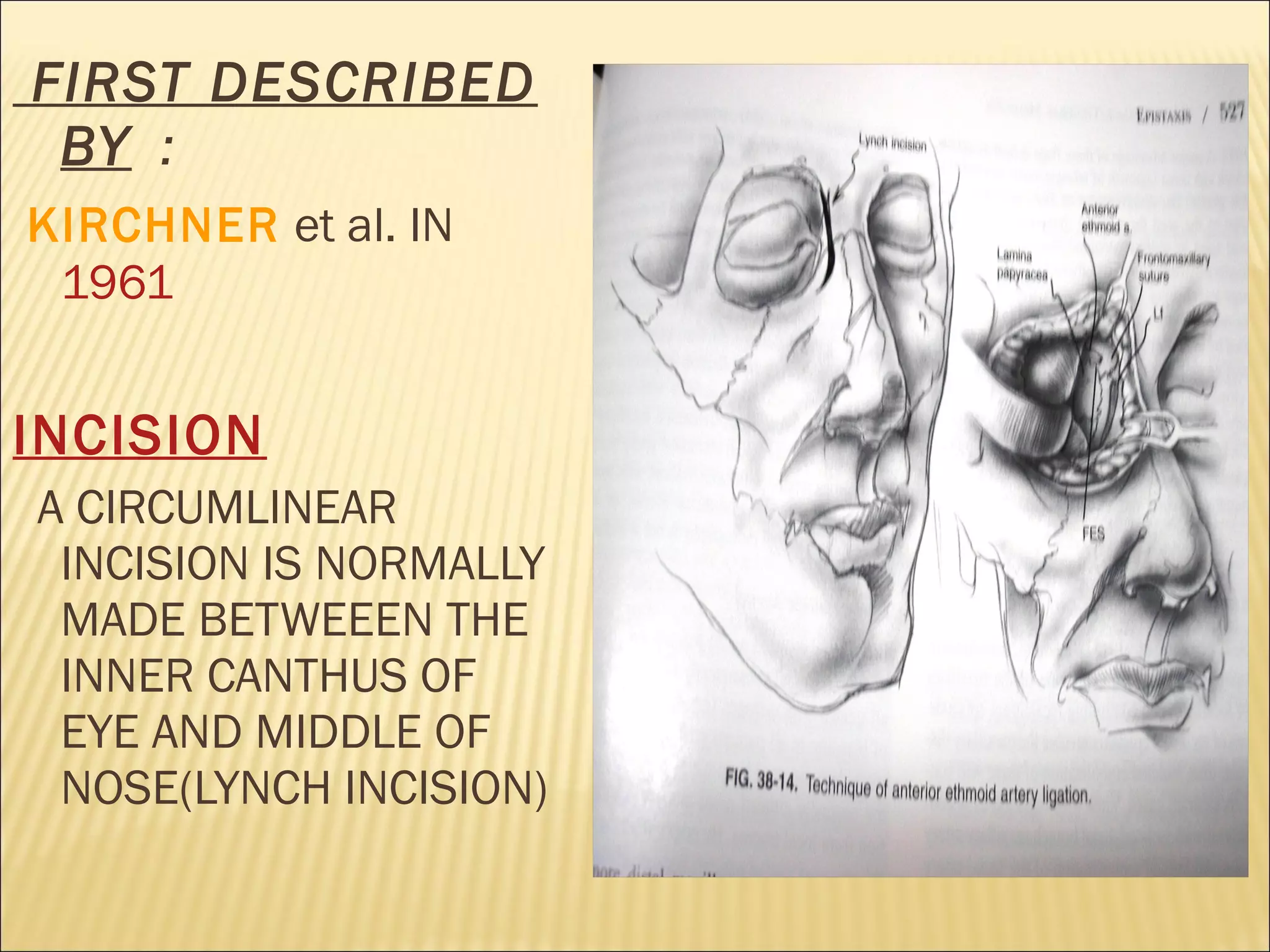 VESSEL ligation | PPT