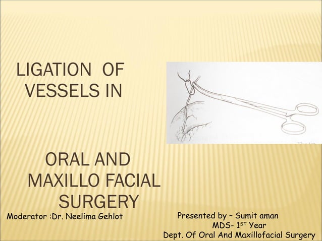 VESSEL ligation | PPT
