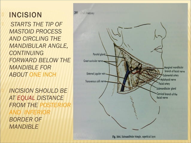 VESSEL ligation | PPT