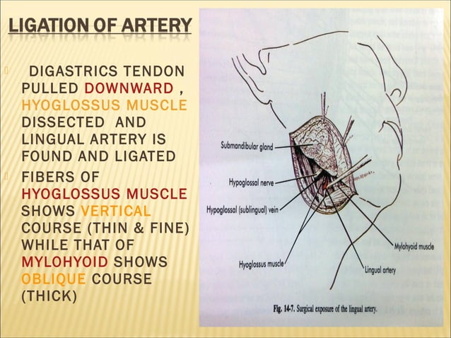 VESSEL ligation | PPT