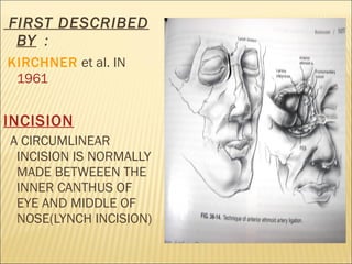 VESSEL ligation | PPT