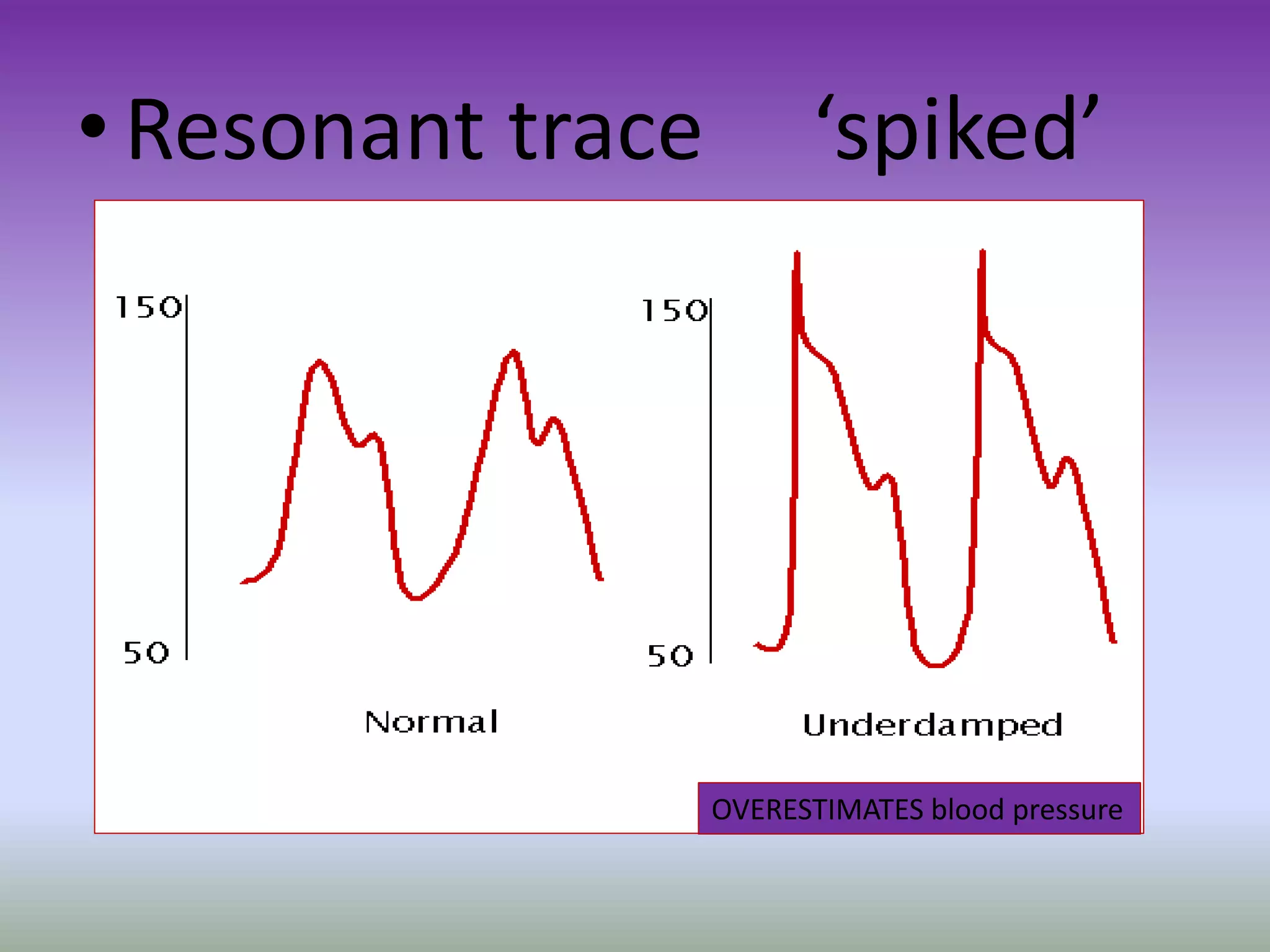 Arterial line analysis | PPTX