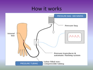 Arterial line analysis | PPTX