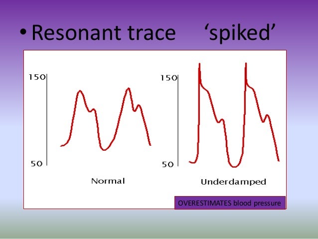 Arterial line analysis