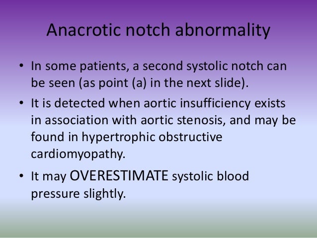 Arterial line analysis