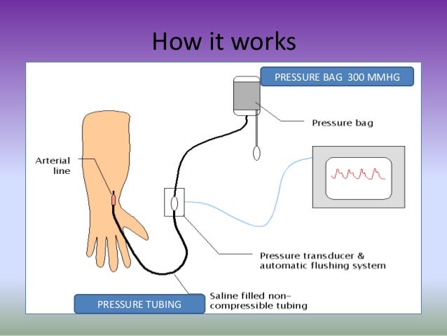 Arterial line analysis
