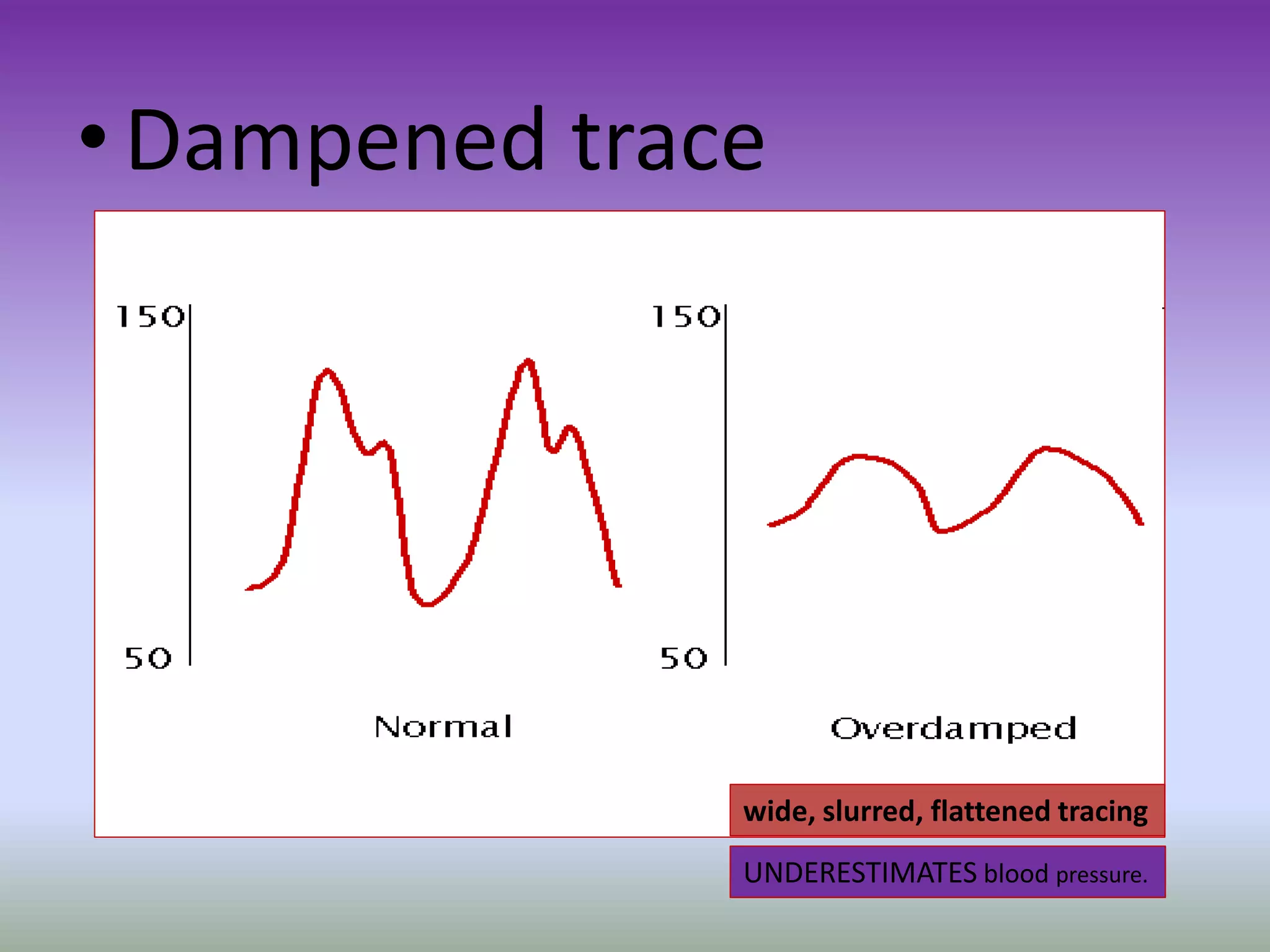 Arterial line analysis | PPTX