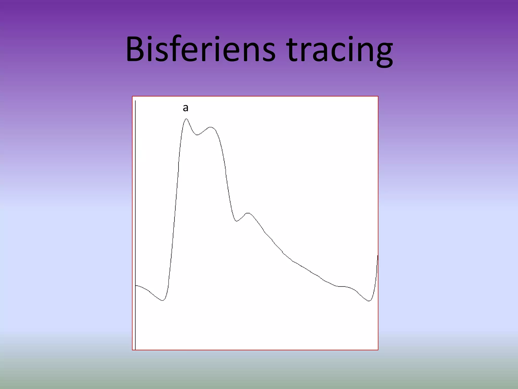 Arterial line analysis | PPTX