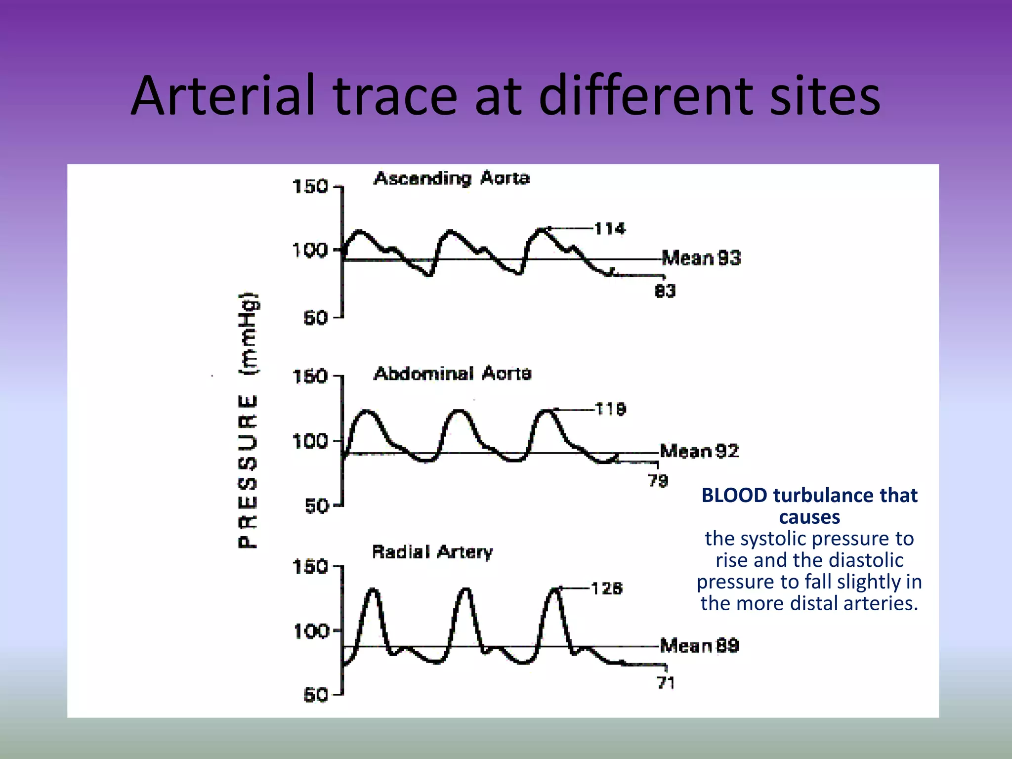 Arterial line analysis | PPTX