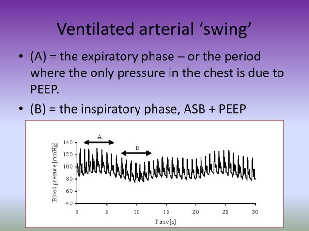 Arterial line analysis | PPT