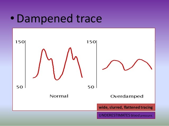 Arterial line analysis