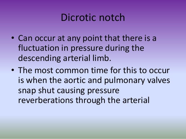 Arterial line analysis