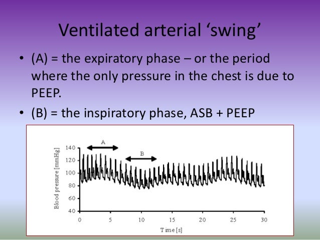Arterial line analysis