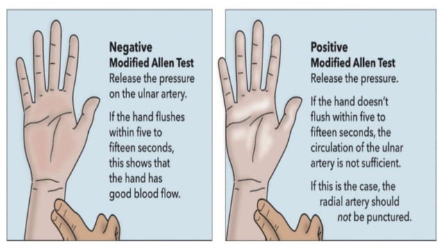 arterial line insertion in paediatric practice | PPTX | Heart and ...