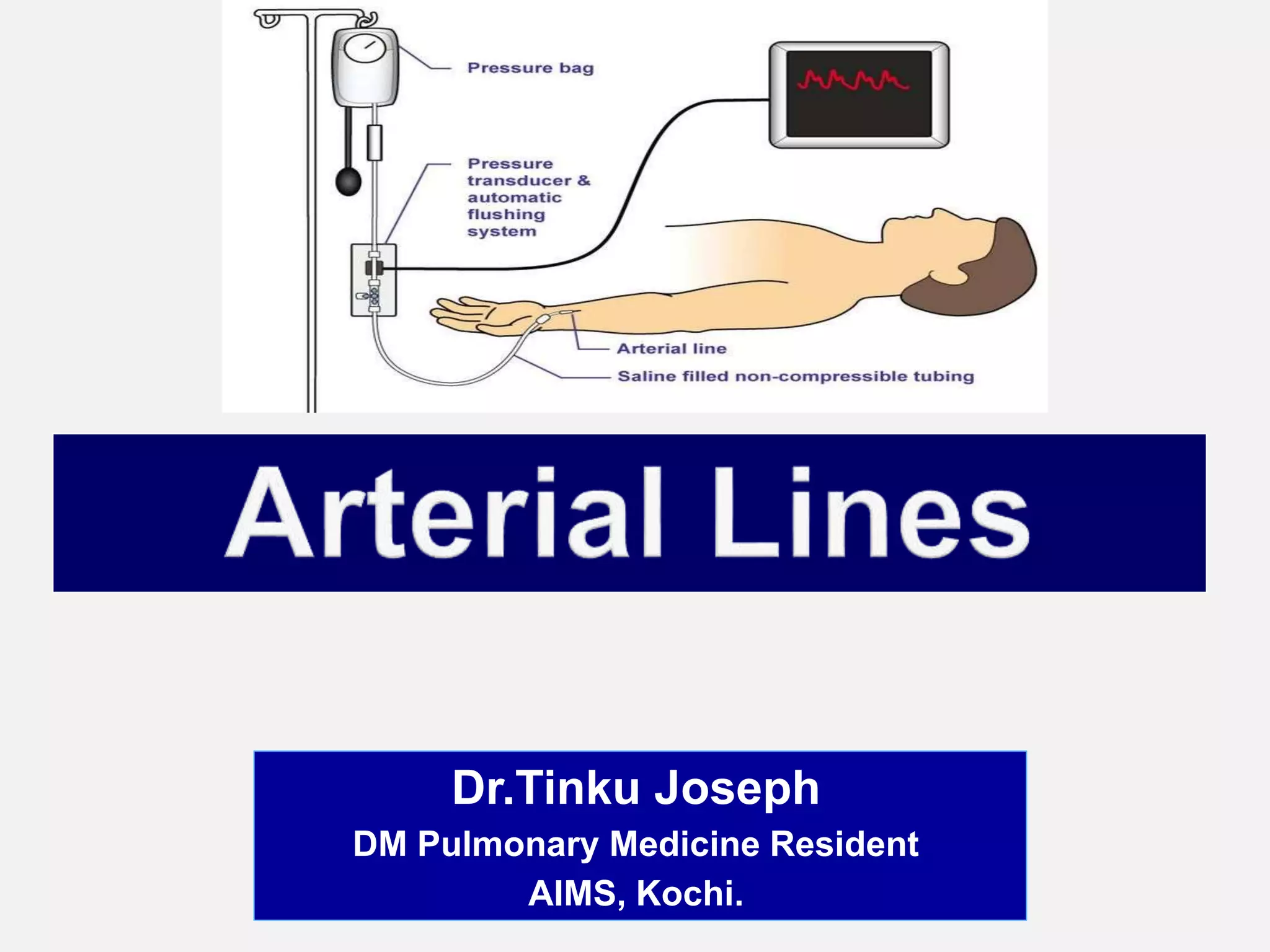 Arterial lines by Dr.Tinku Joseph | PPTX