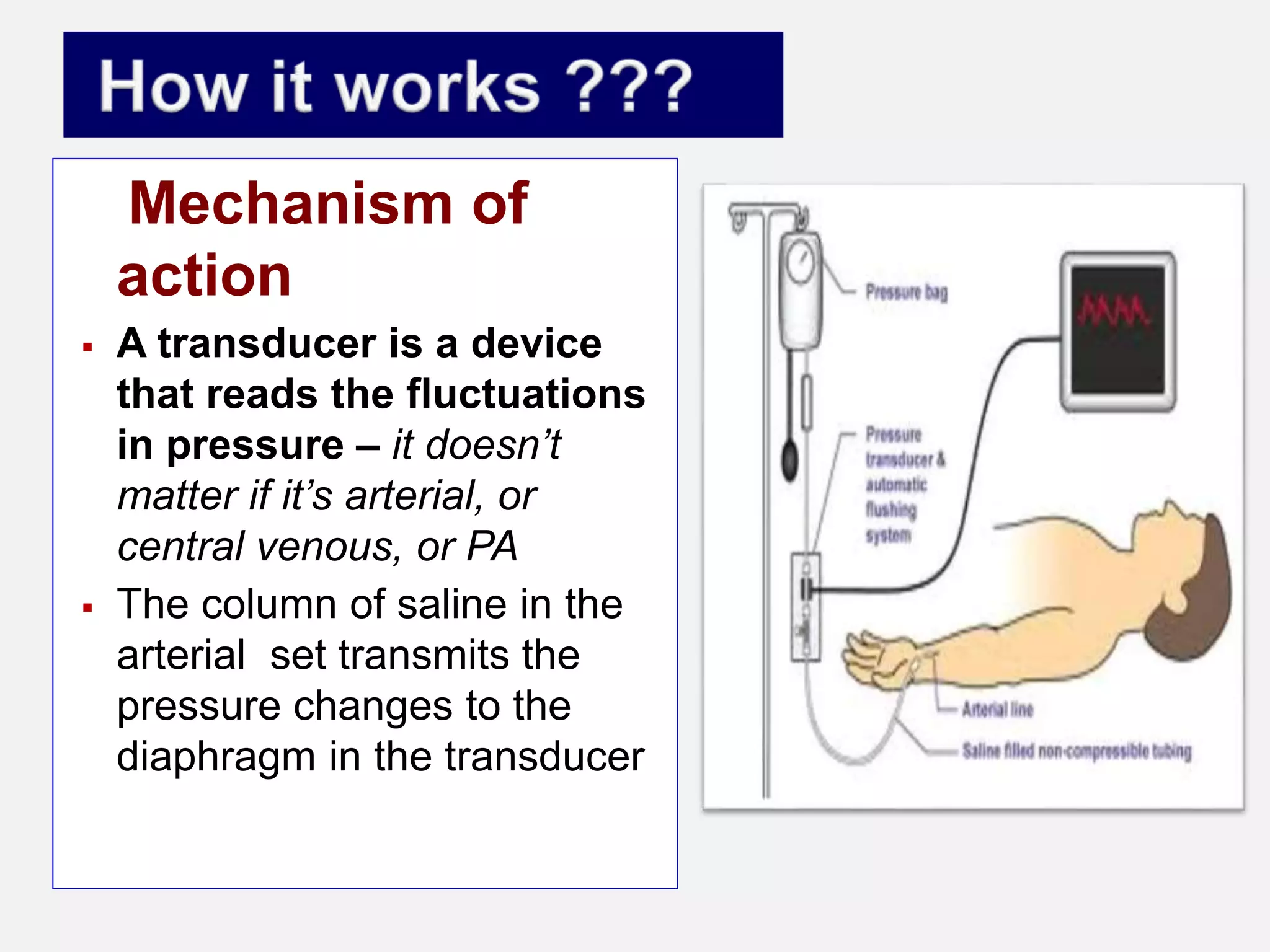 Arterial lines by Dr.Tinku Joseph | PPTX