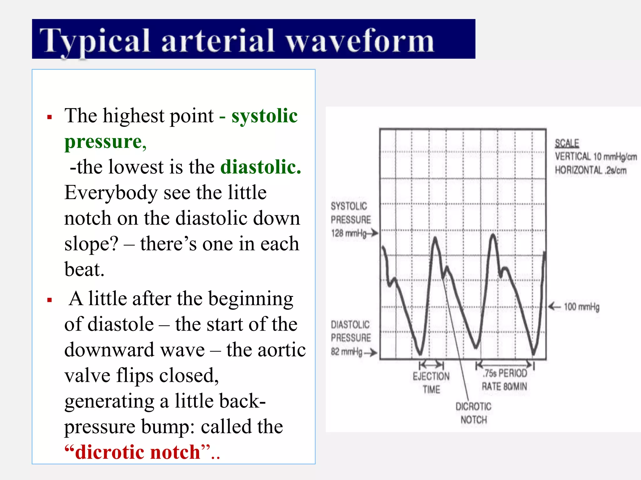 Arterial lines by Dr.Tinku Joseph | PPTX