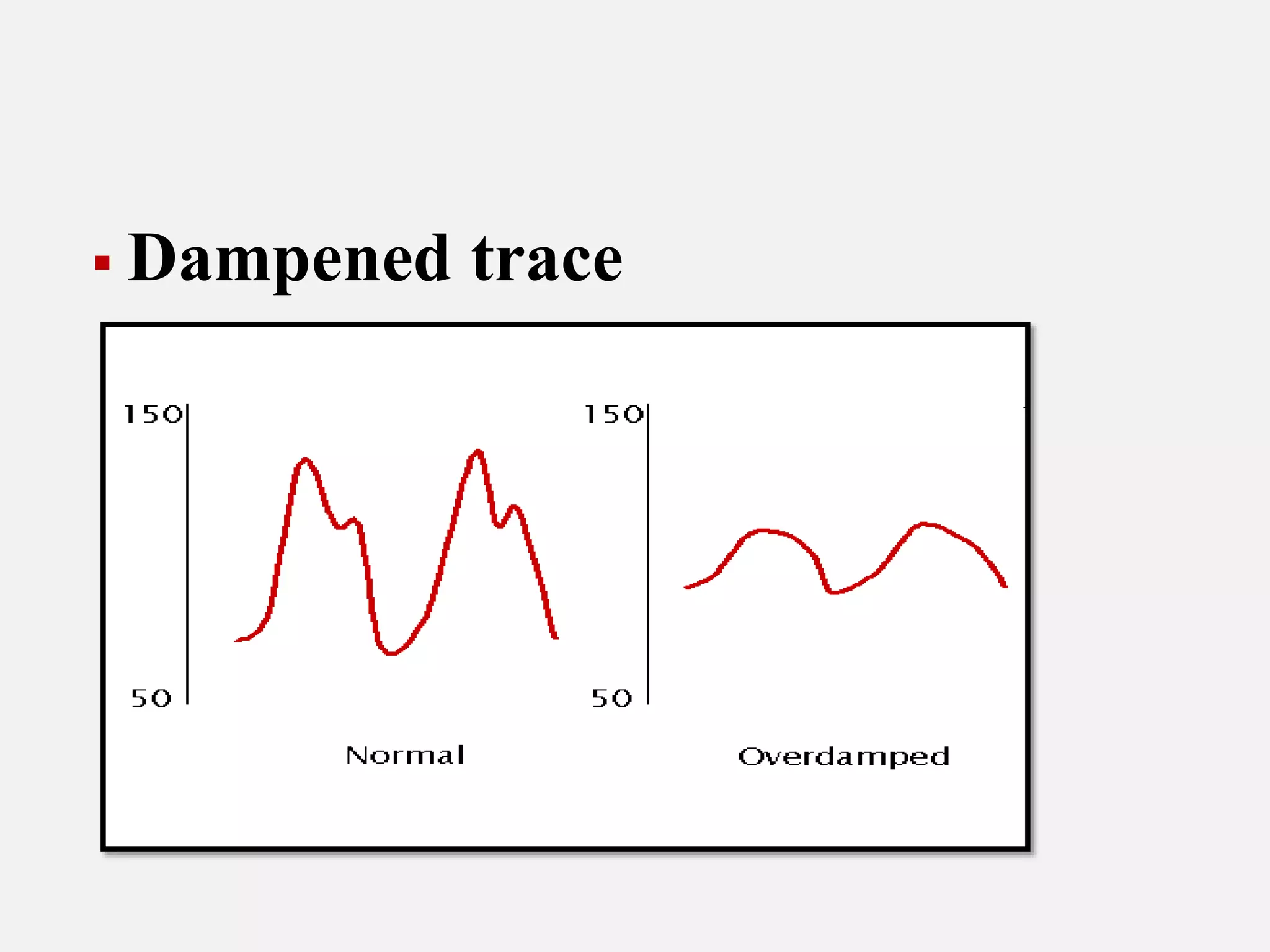 Arterial lines by Dr.Tinku Joseph | PPTX
