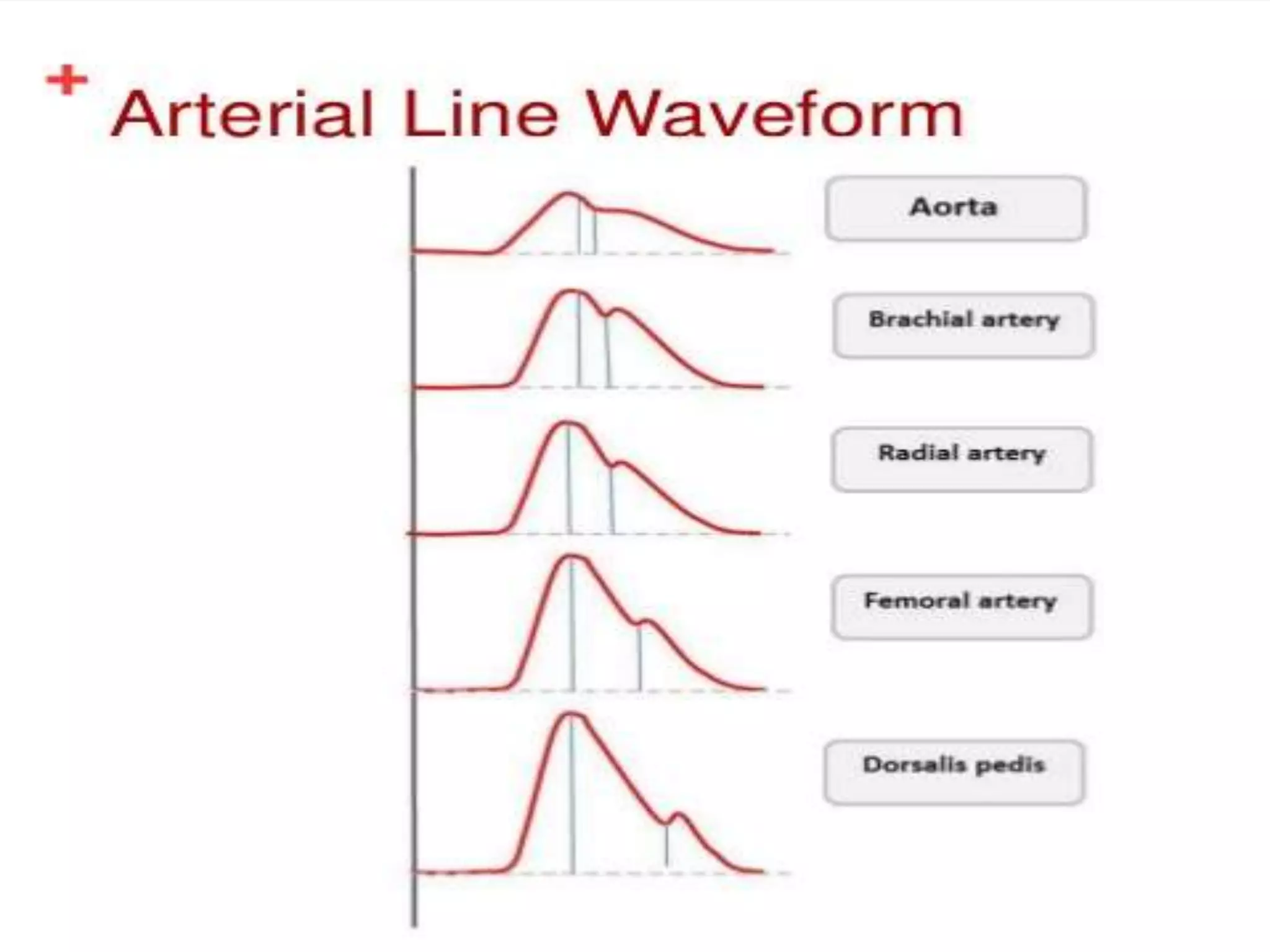 Arterial lines by Dr.Tinku Joseph | PPTX