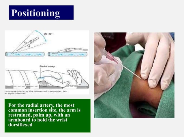 Arterial lines by Dr.Tinku Joseph | PPTX | First Aid | Injuries