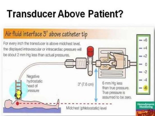 Arterial lines by Dr.Tinku Joseph | PPTX | First Aid | Injuries